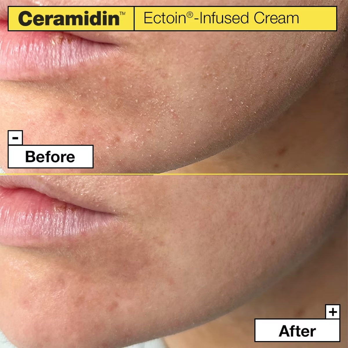 Dr. Jart+ • Ceramidin Crème à l’Ectoïne 50 ml • haar-shop.ch