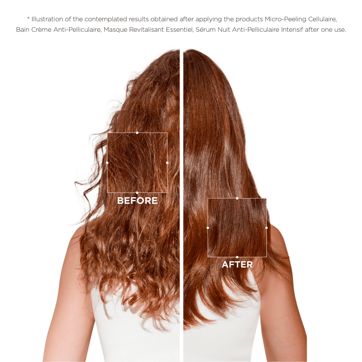 Kérastase • Micro-Peeling Cellulaire