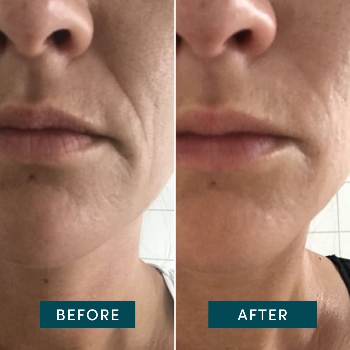 Apricot Beauty • Wiederverwendbare Mund Pads mit Hyaluron 10 g
