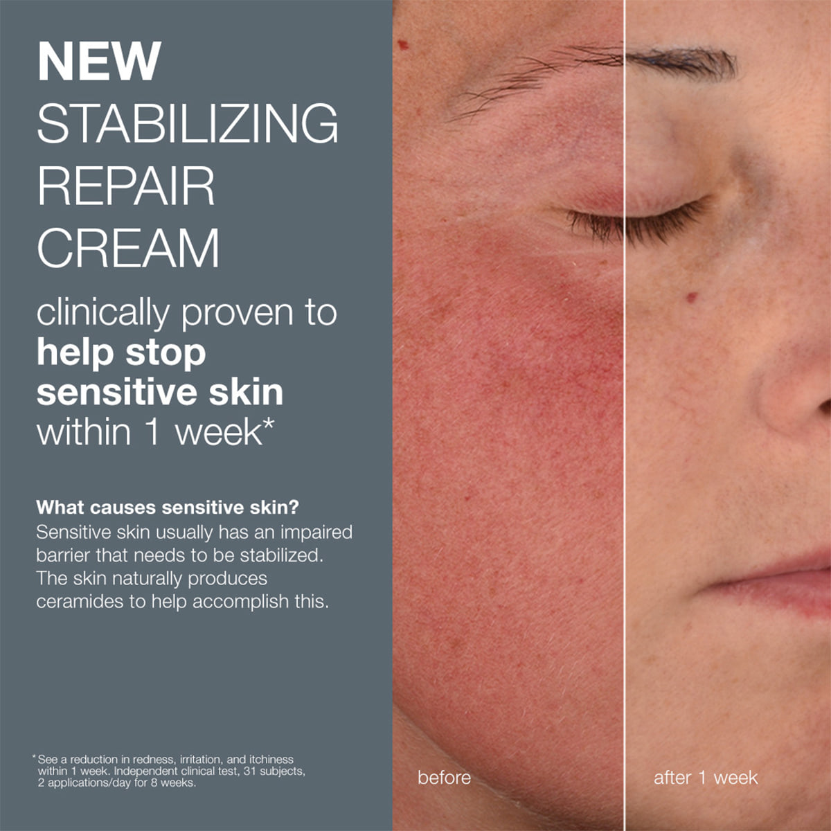 Stabilizing Repair Cream