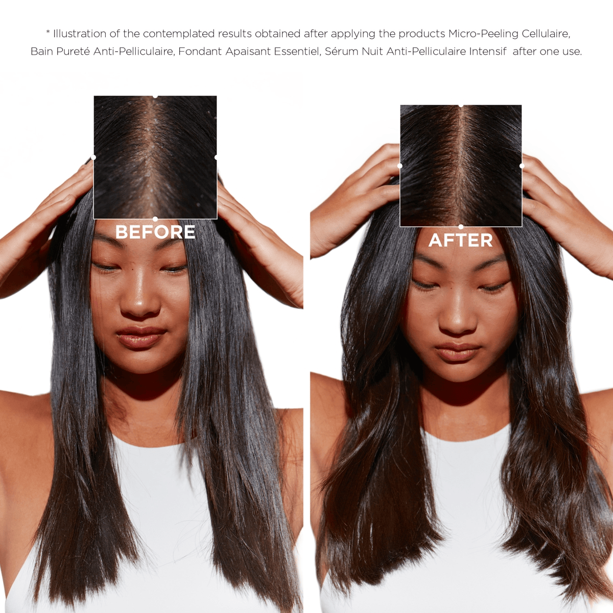 Kérastase • Micro-Peeling Cellulaire