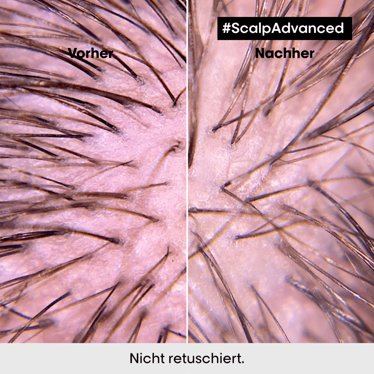 L'Oréal Professionnel • Scalp Advanced Anti-Discomfort Soother