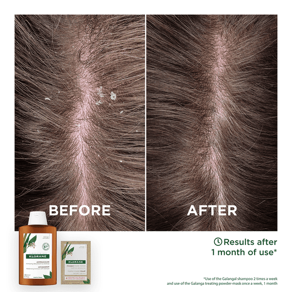 Klorane Galanga Powder Mask 8x3g • Natural Hair Care Products