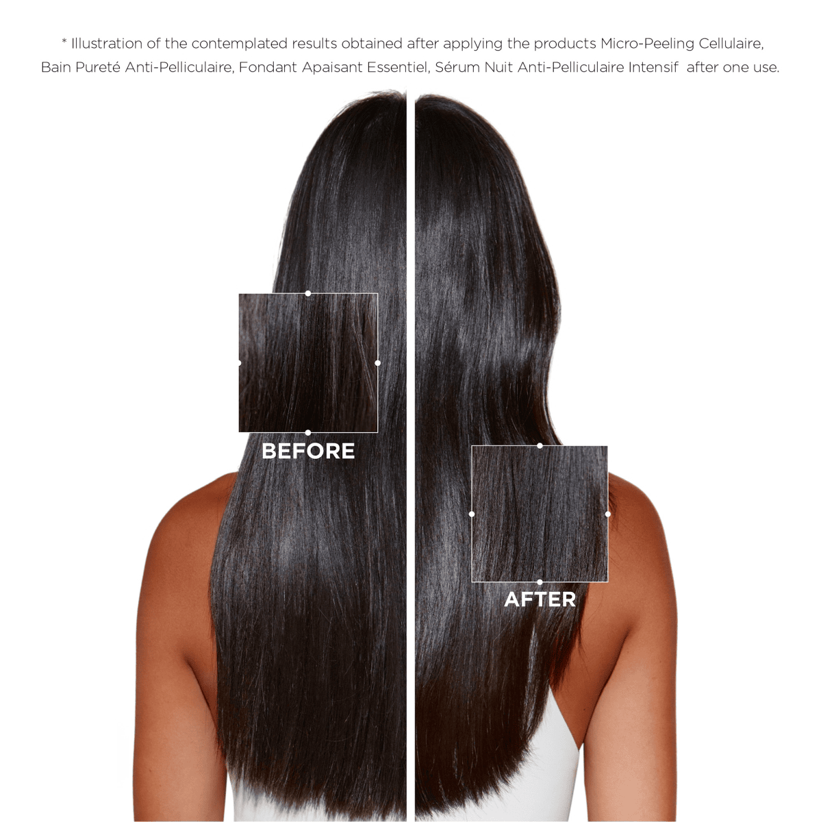 Kérastase • Micro-Peeling Cellulaire